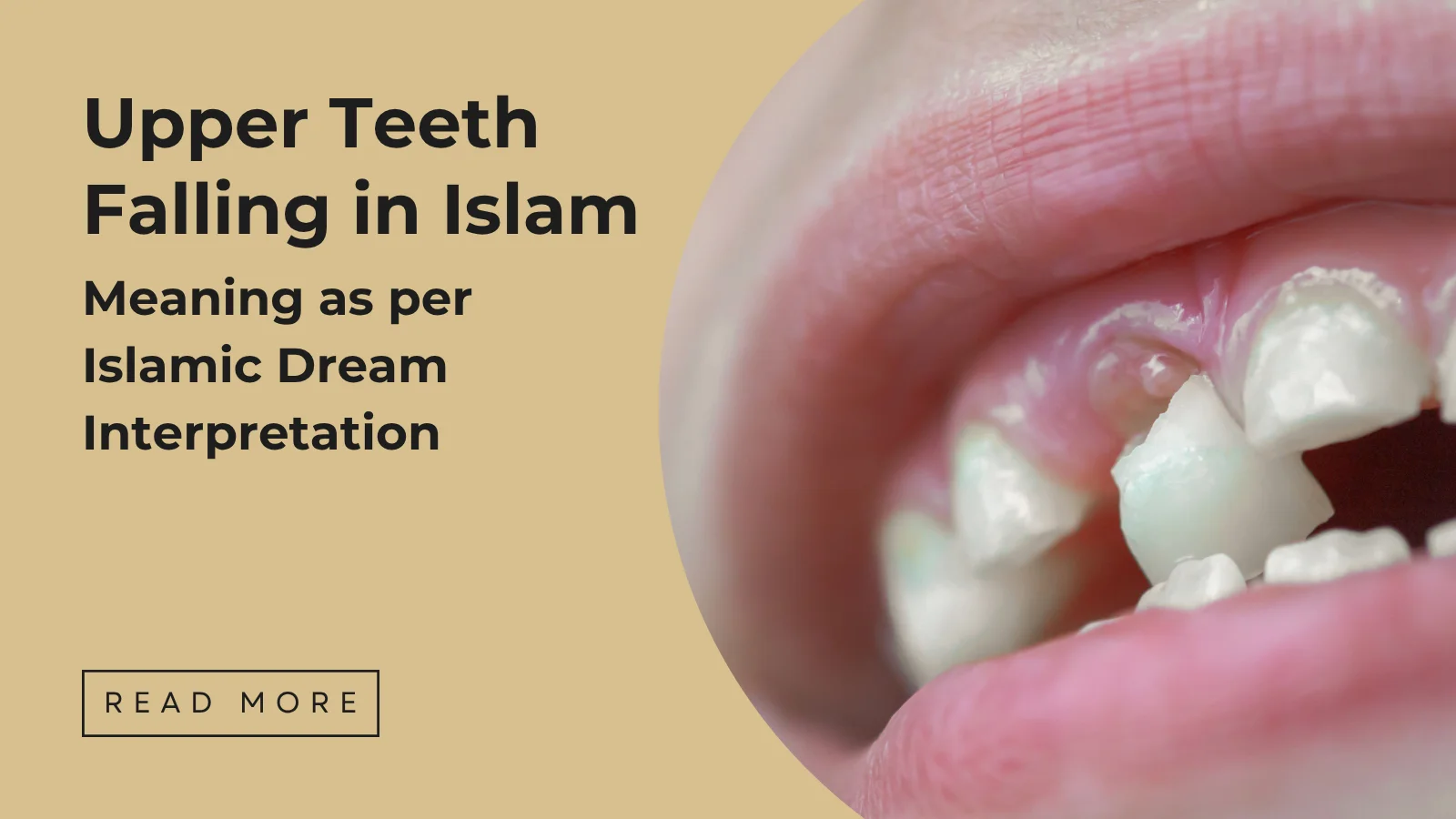 Upper Teeth Falling in Islam - Dream Meaning & Interpretation